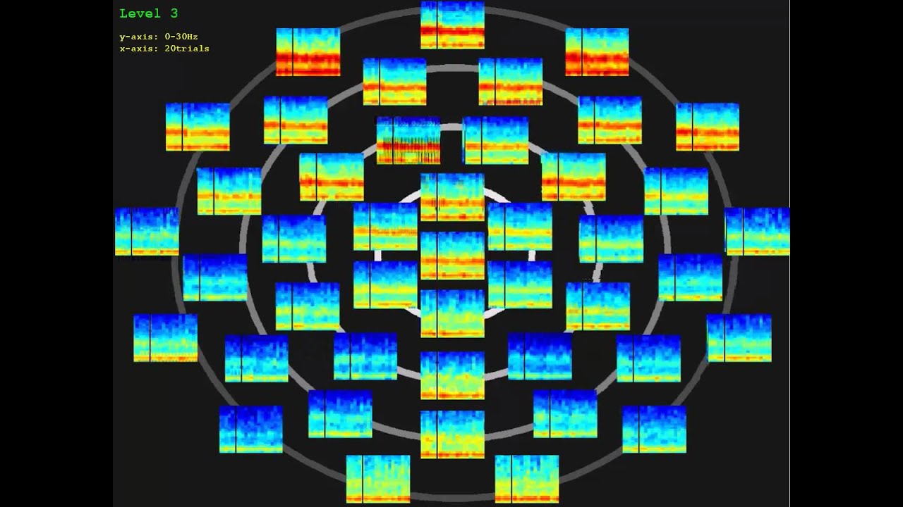 MIT visualizes how the brain loses and regains consciousness - YouTube