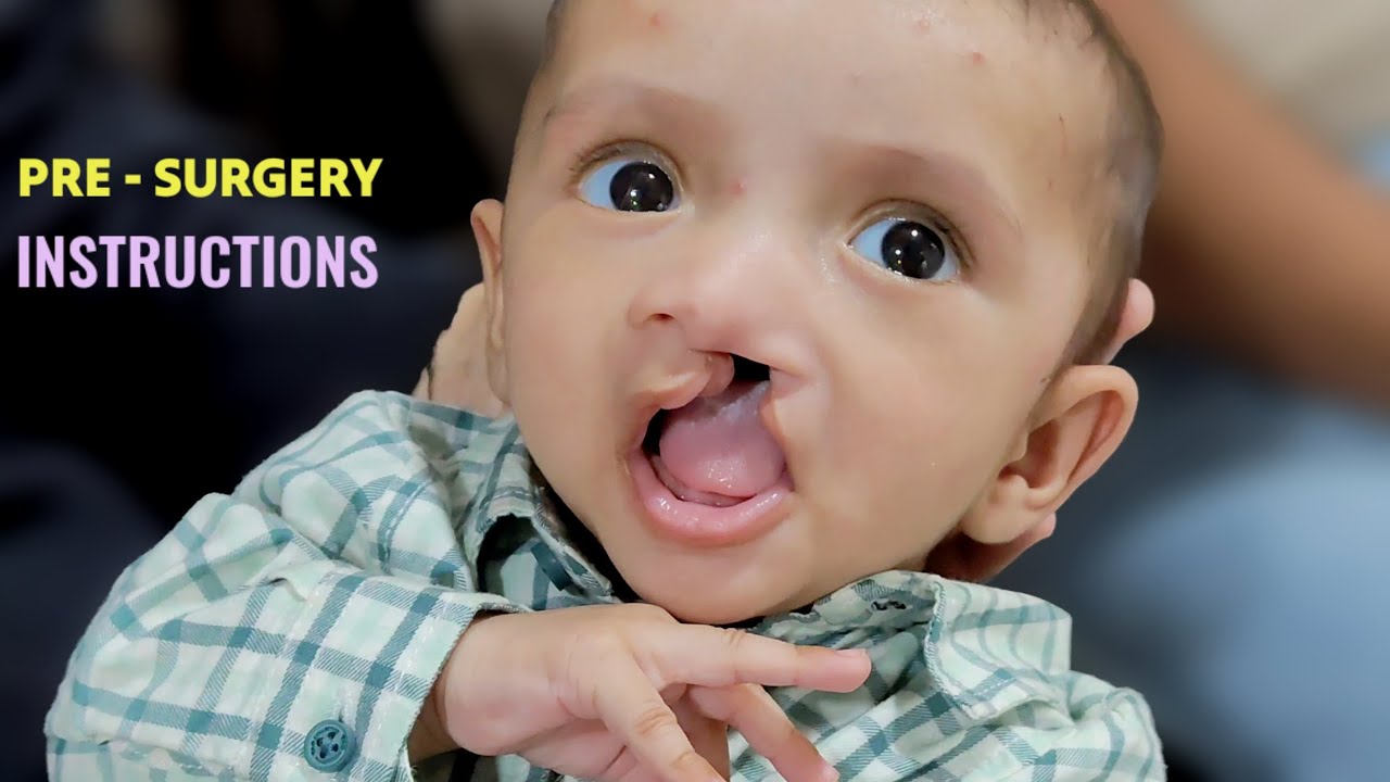 Cleft Lip Surgery: Essential Pre-Op Instructions by Dr. Parit Ladani ...