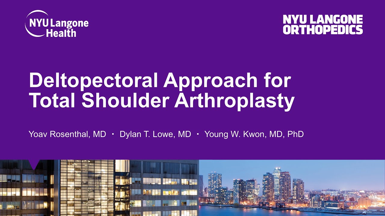 Deltopectoral Approach for Total Shoulder Arthroplasty - YouTube