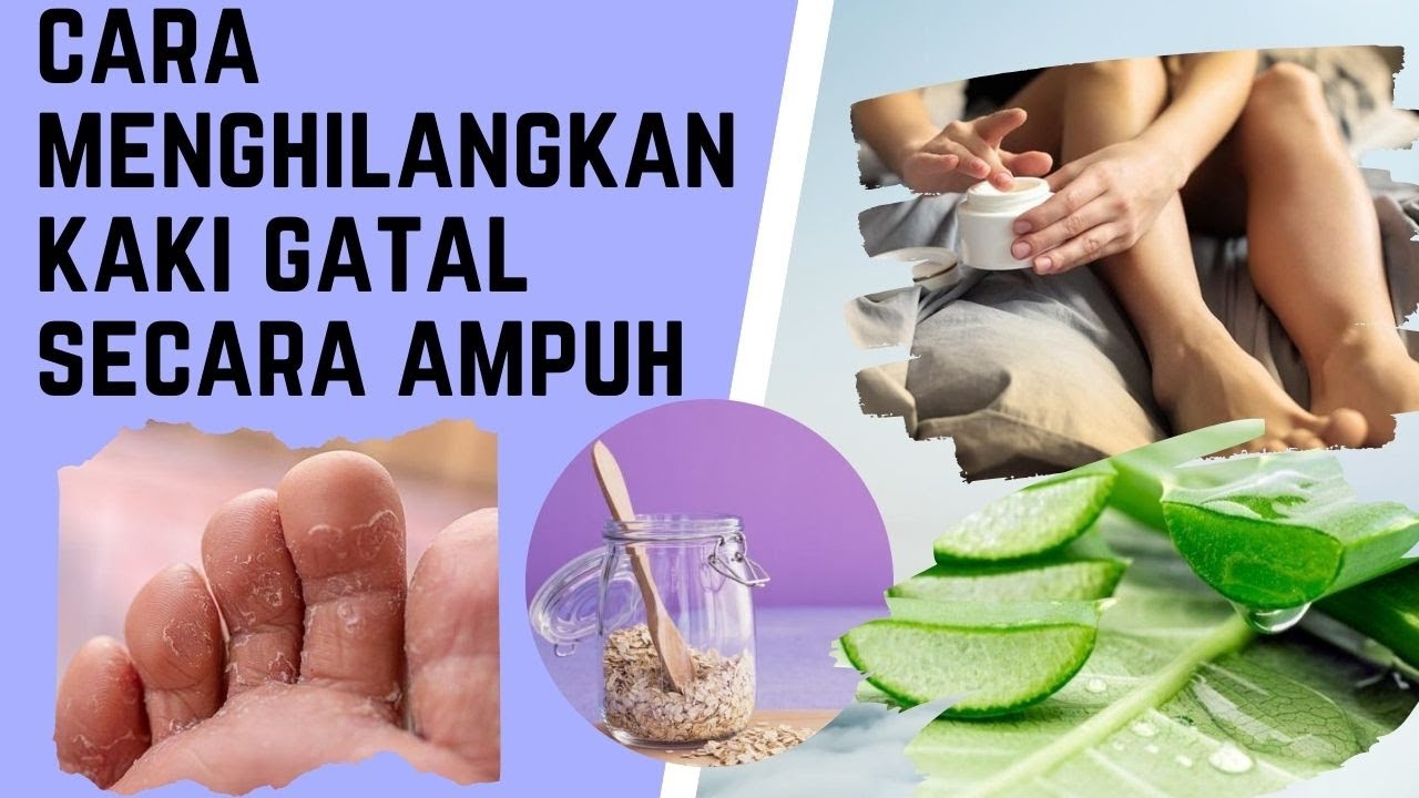 Cara menghilangkan kaki gatal gatal ! terbukti ampuh - YouTube