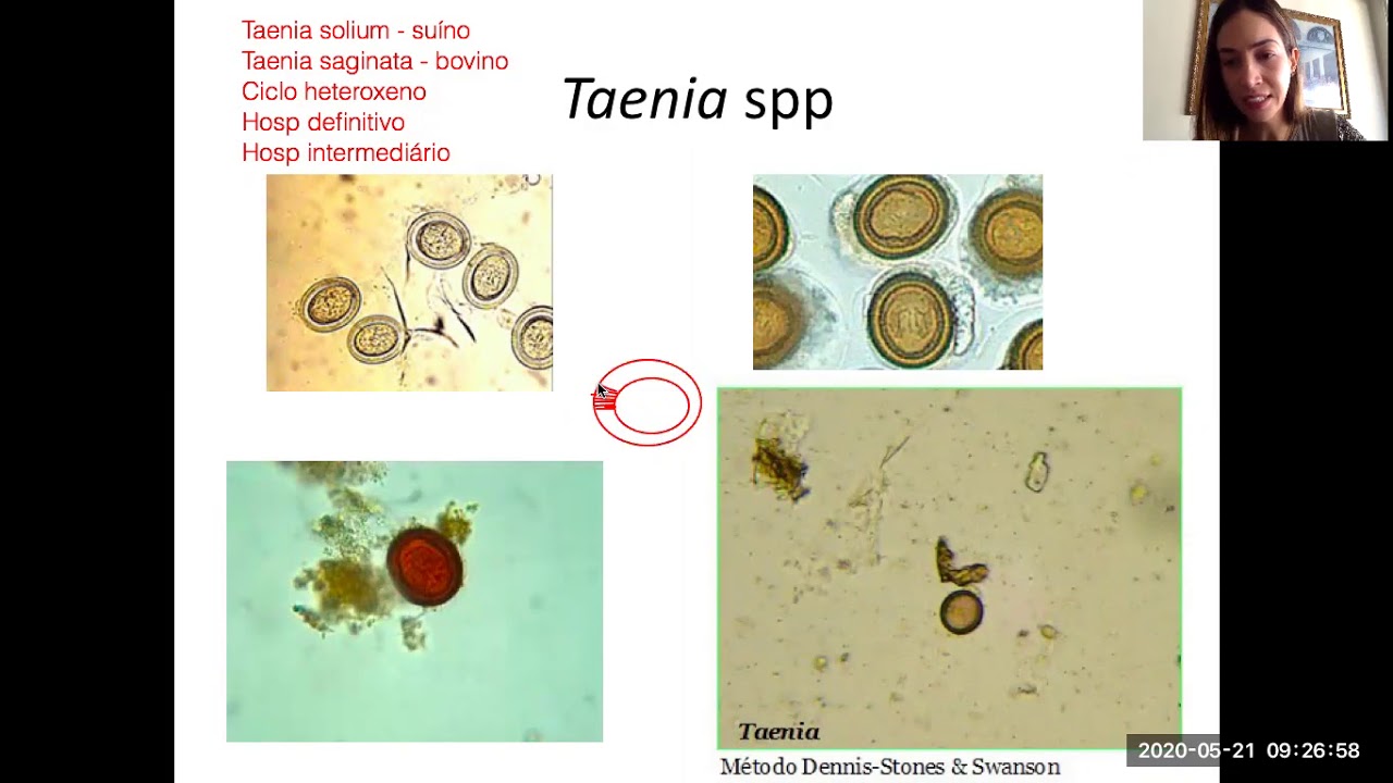 Ovo De Tenia Taenia Solium Disease In Humans And Pigs: An Ancient