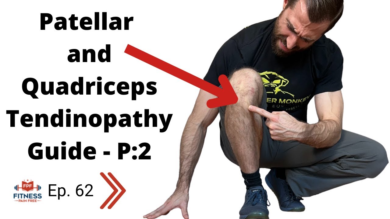 Patellar Tendinopathy Evidence Based Guide Diagnosis And Treatment
