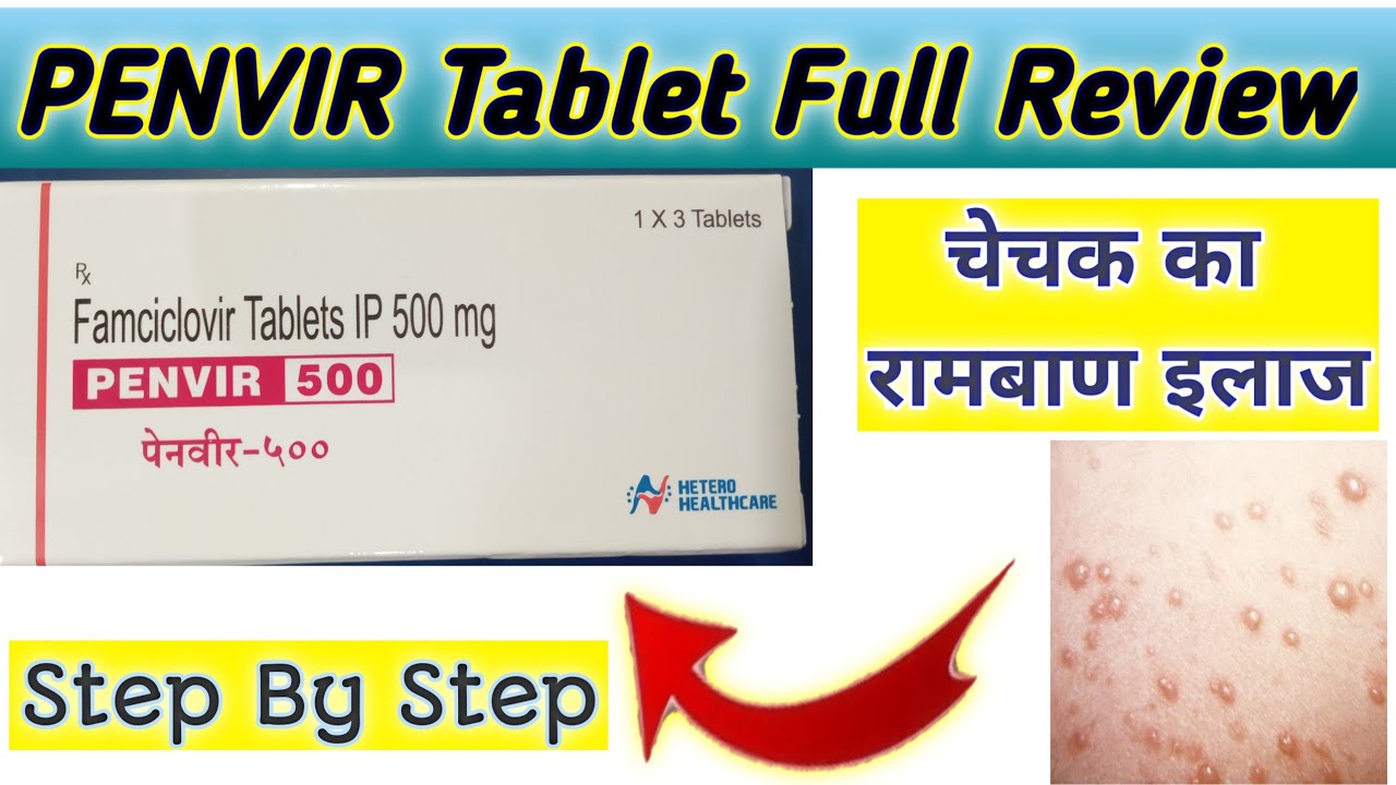 PENVIR 500 mg / chickenpox, Genital herpes / Uses, Precaution, side ...