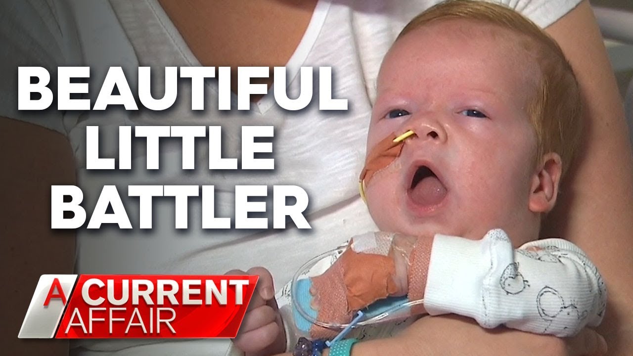 Family's courage in face of baby Eli's rare diagnosis | A Current ...