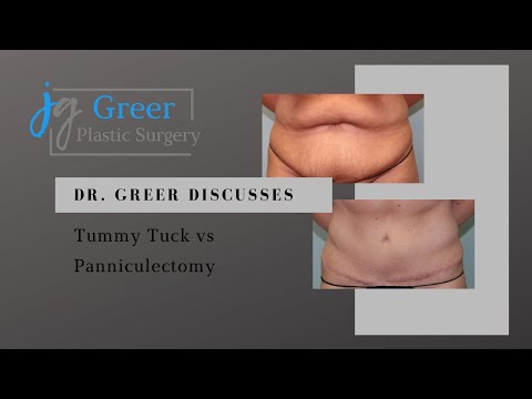Tummy Tuck vs  Panniculectomy | Greer Plastic Surgery | Cleveland, OH