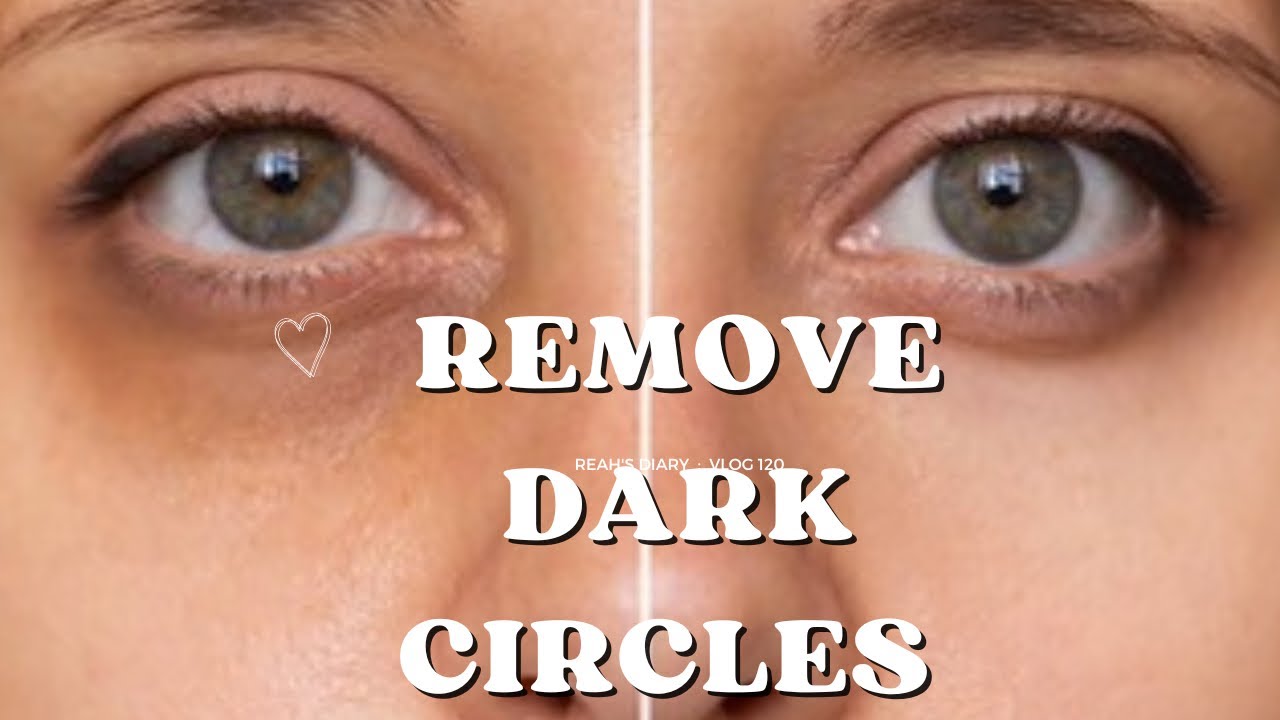 Remove dark circles within 3 days|how to get rid of dark circles ...