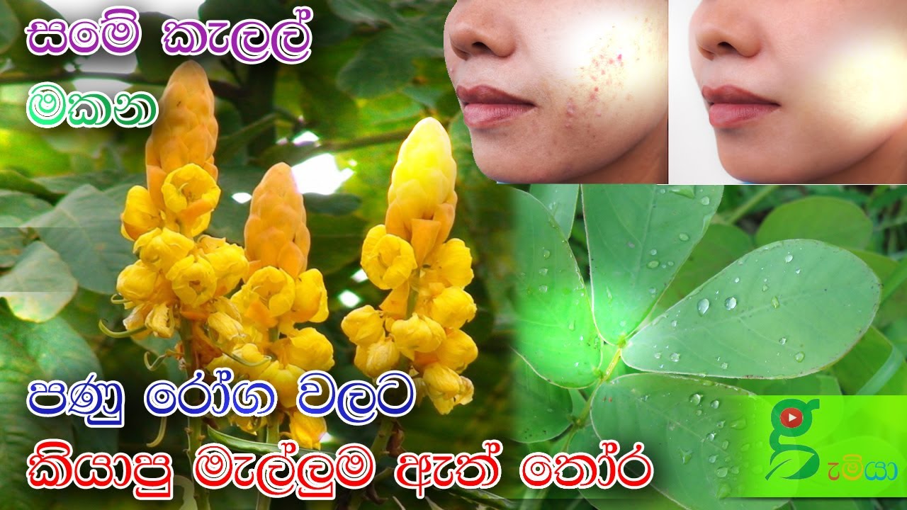 42 ඔයාගෙ හමෙත් කැලැල් තියනවද ? ඇත් තෝර - පැනි තෝර - පෙති තෝර වවමු ...