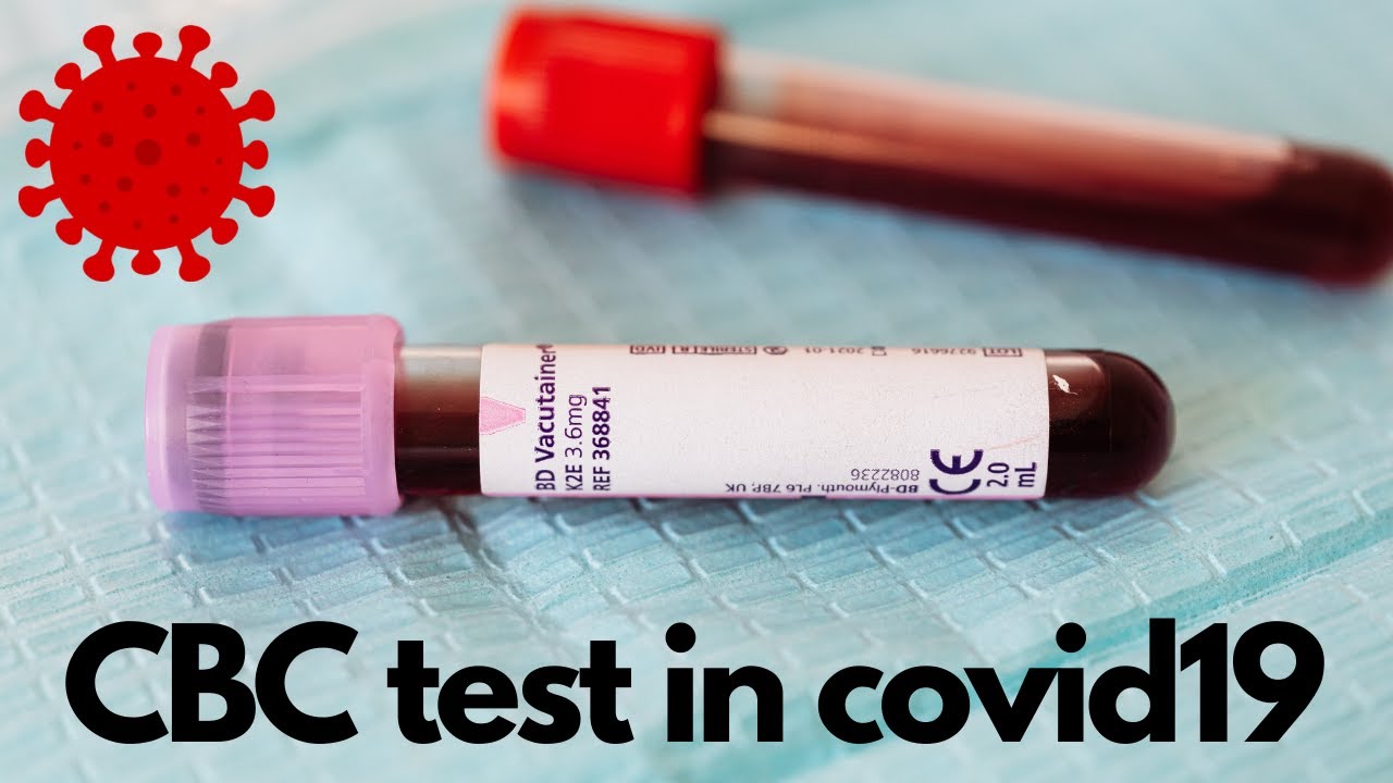 Complete Blood Count (CBC) Test | Importance of CBC in covid 19 | judge ...