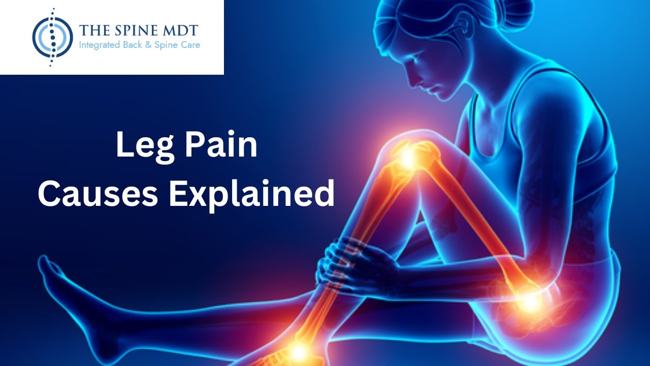 Leg pain. Causes explained - YouTube