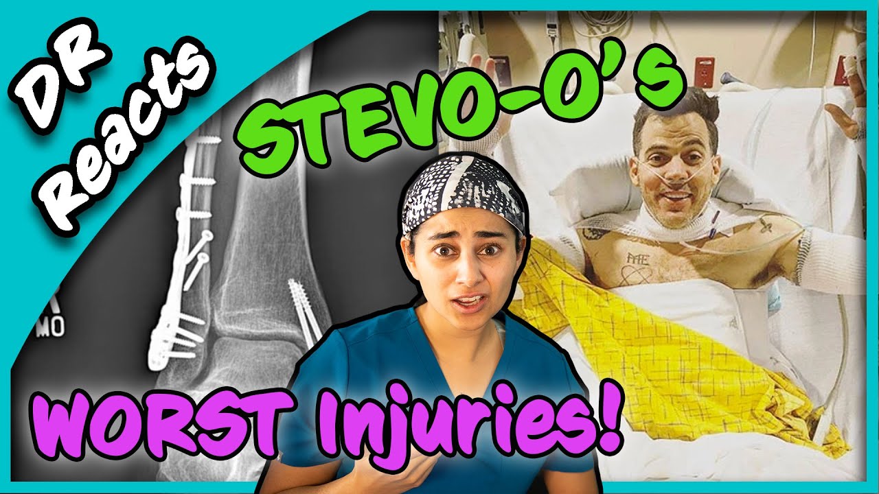 Doctor Explains Steve-O's 10 WORST Stunt INJURIES | A Medical BREAKDOWN ...
