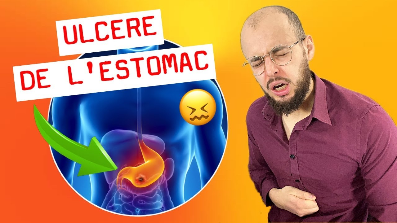 Ulcère de l'estomac : Les VRAIES causes ! - YouTube