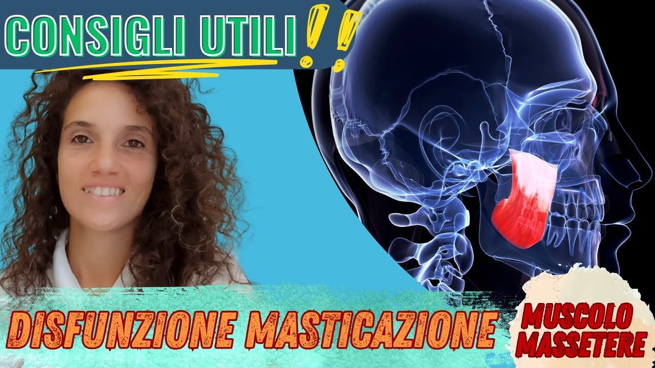 MUSCOLO MASSETERE: cos'è e come si tratta - YouTube
