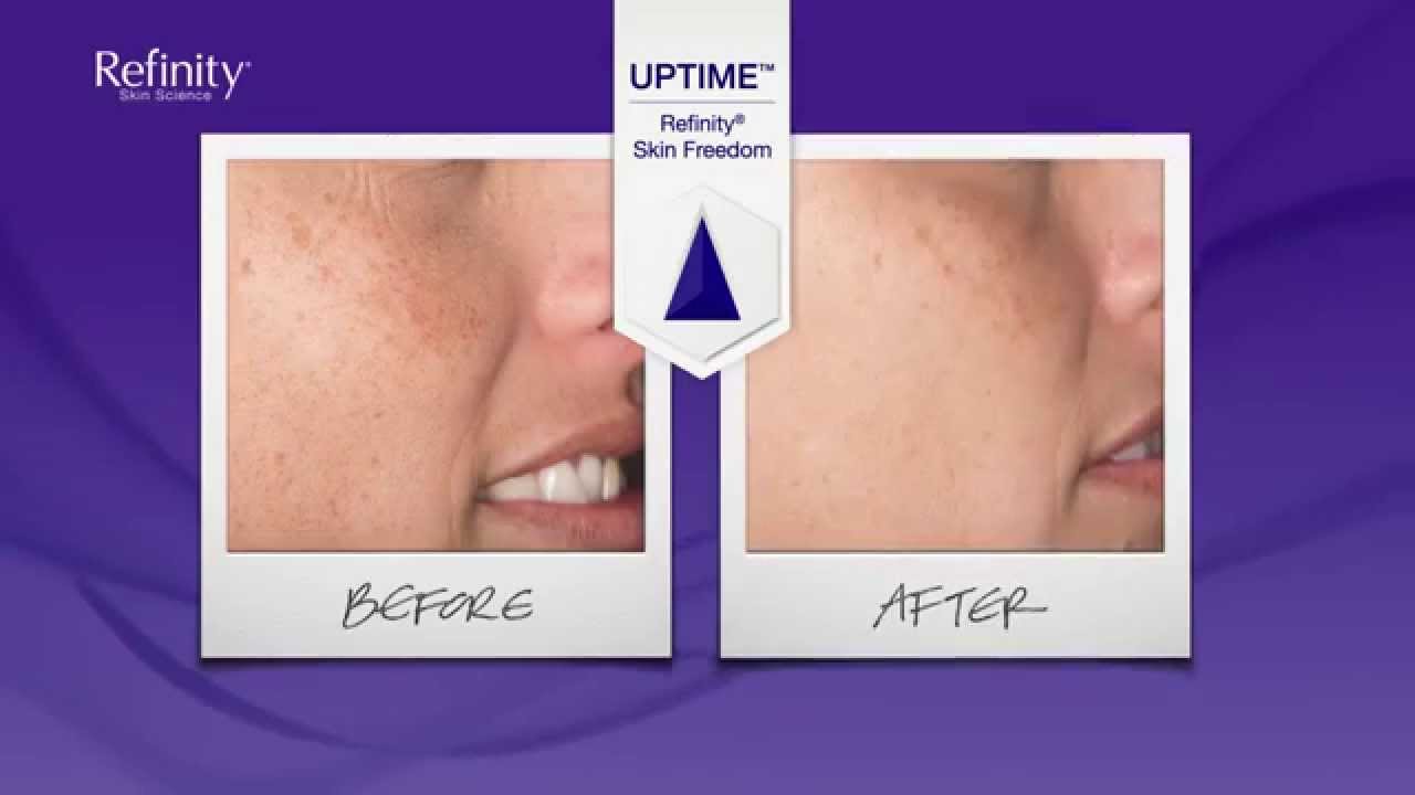 Refinity Demonstration Edit - YouTube