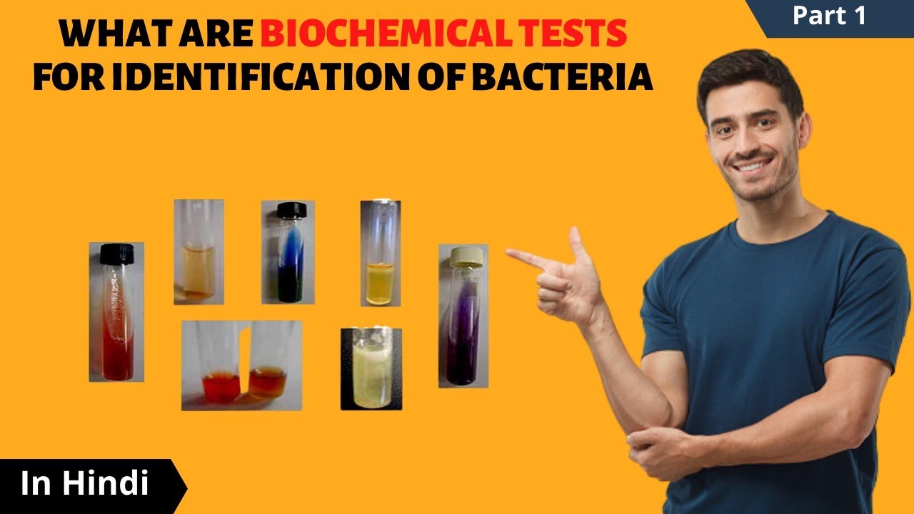 Biochemical Tests for Identification of Bacteria | in Hindi | Catalase ...
