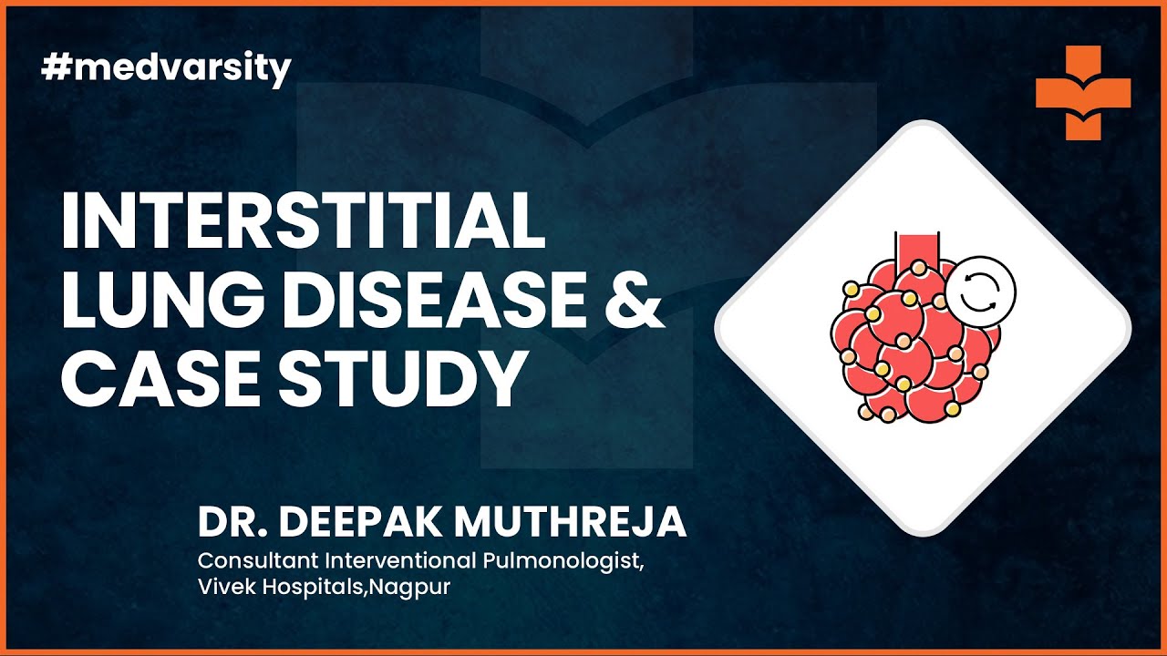 Unmasking Interstitial Lung Disease: A Critical Medical Case Analysis ...