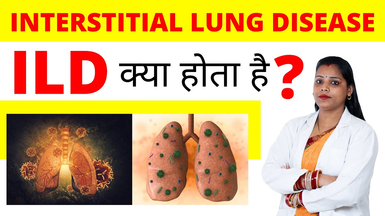 Interstitial Lung Disease (ILD) - Causes, Symptoms, Diagnosis ...