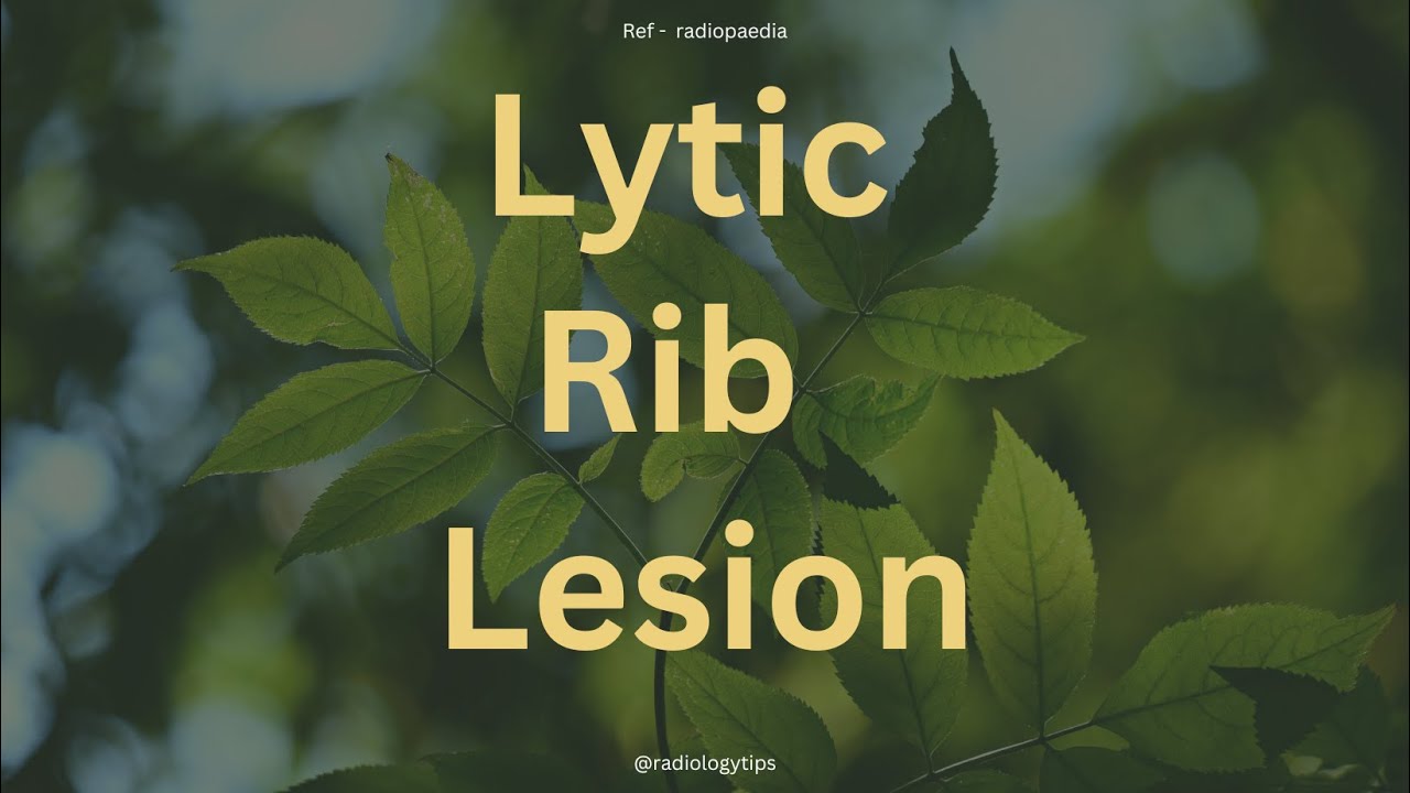 Lytic rib lesion - YouTube