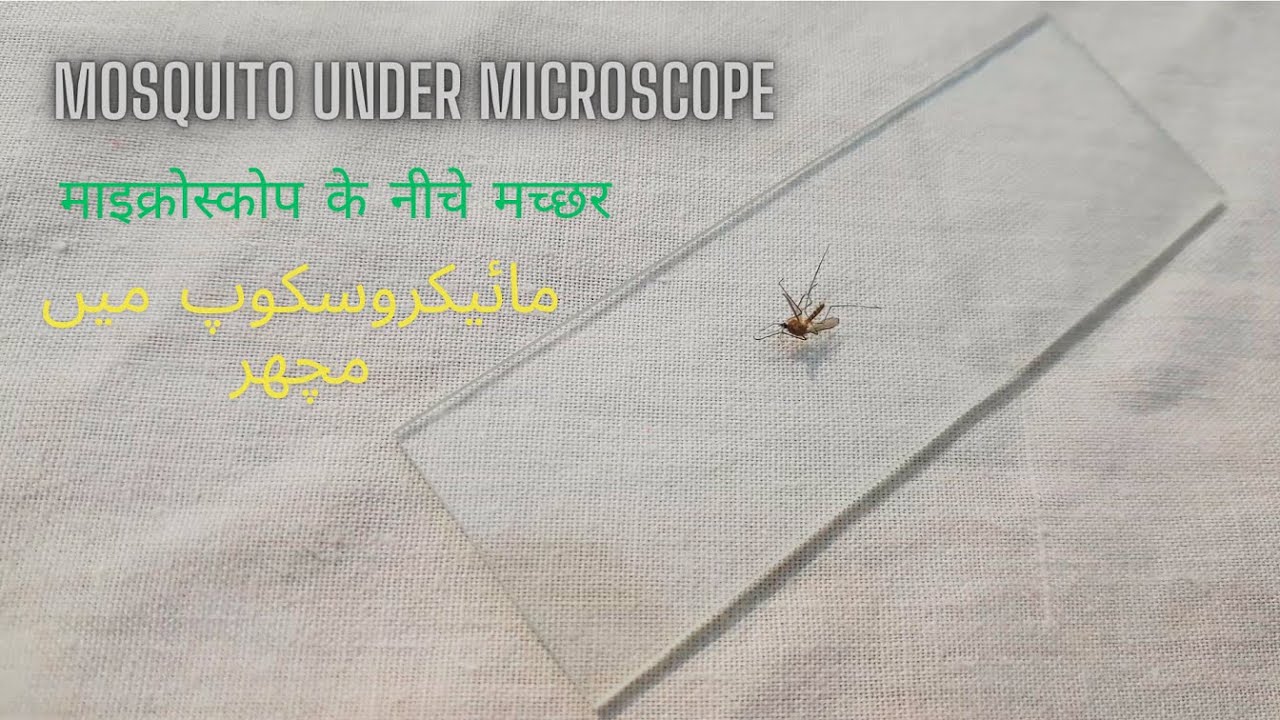 Mosquito Under Microscope #mosquito #microscope | माइक्रोस्कोप के नीचे ...