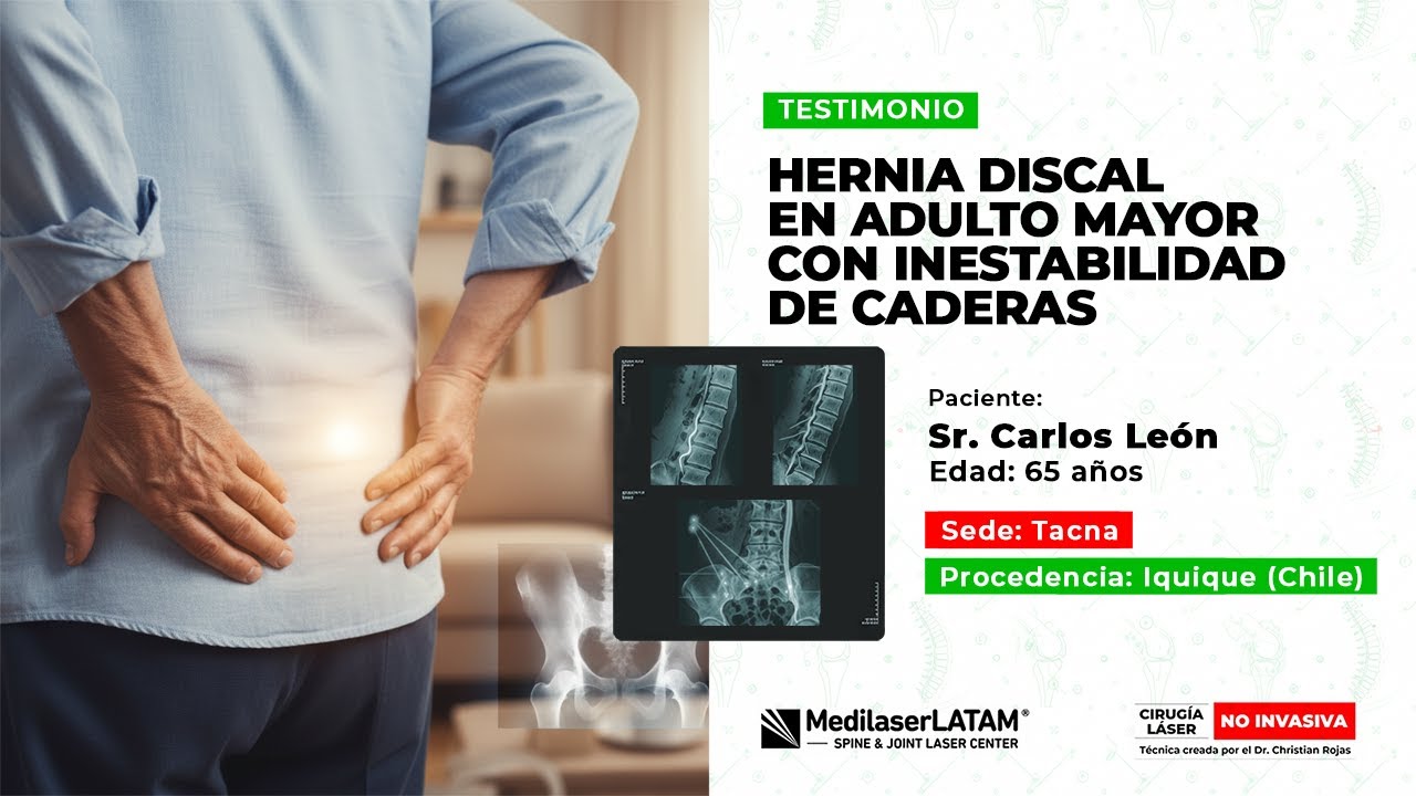 Hernia discal en adulto mayor con inestabilidad de caderas | TESTIMONIO ...