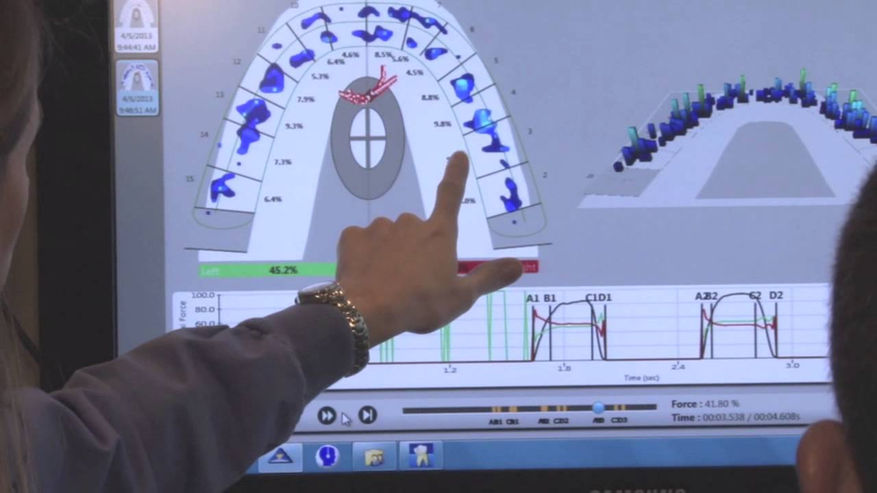 T-Scan Advanced Bite Analysis - YouTube