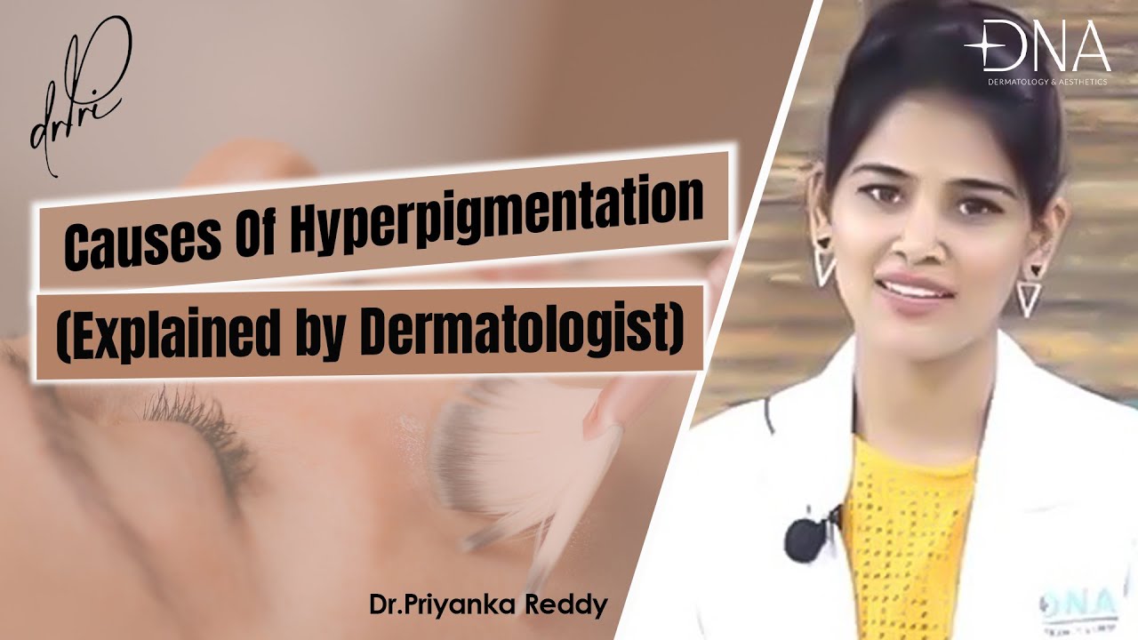 Causes of Facial Hyperpigmentation | Dark Spots on Face | Dr. Priyanka ...