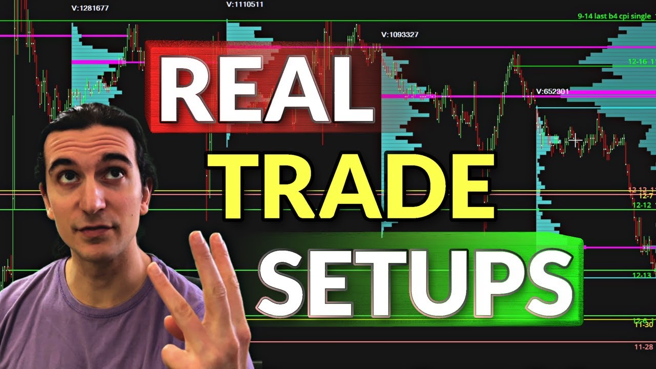 3 Day Trade Breakdowns Bonds Order Flow Nuances YouTube 3-day-trade-breakdowns-bonds-order-flow-nuances-youtube