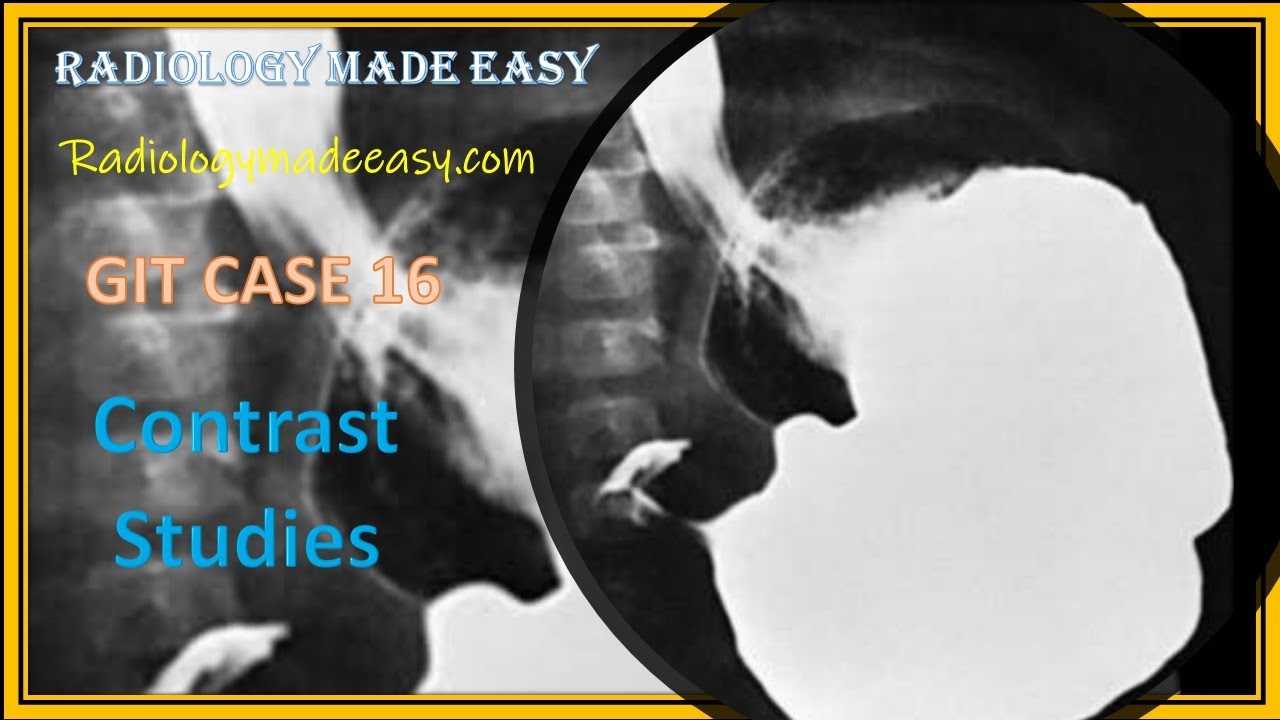 FRCR Radiology GIT Contrast cases 16: 4 weeks old baby presented with ...