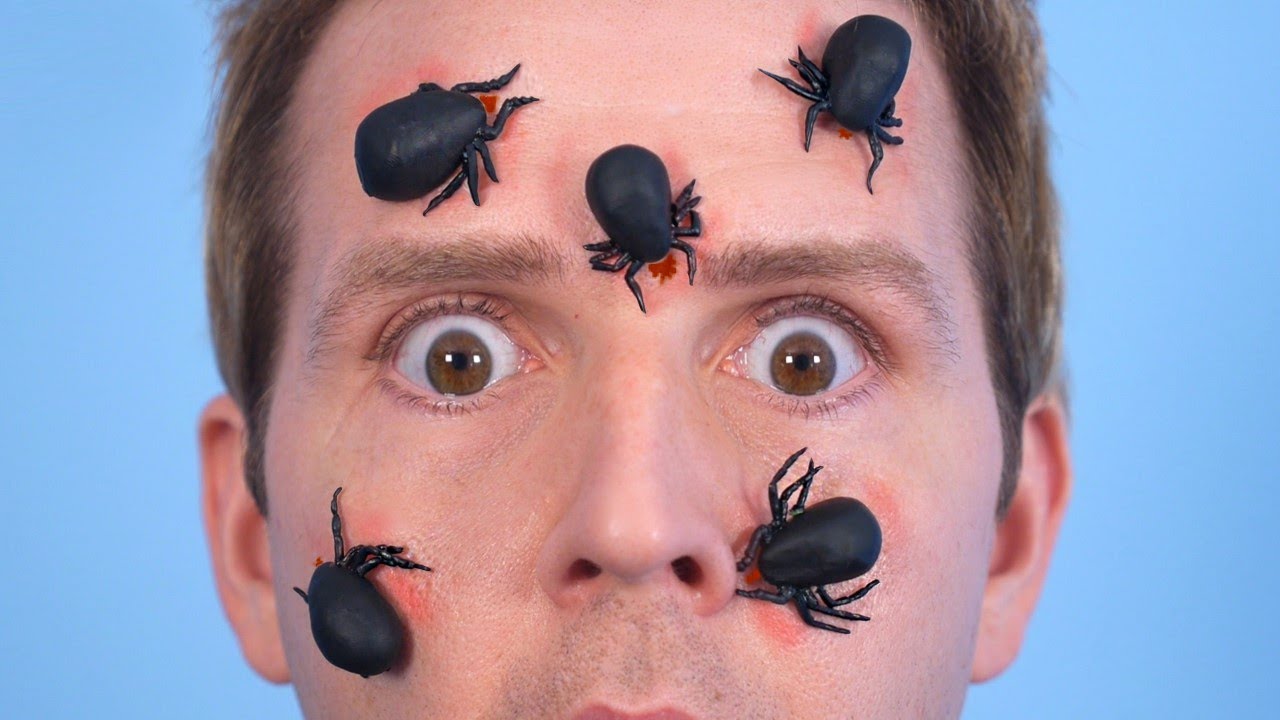 FACE COVERED WITH TICKS! - YouTube
