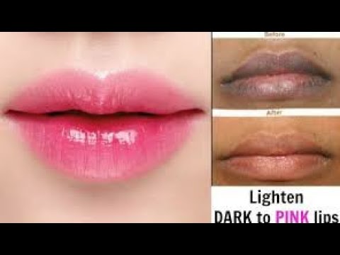 SAY NO TO DARK LIPS || HOME MADE LIP BALM || GET PINK LIPS NATURALLY👍💯 ...