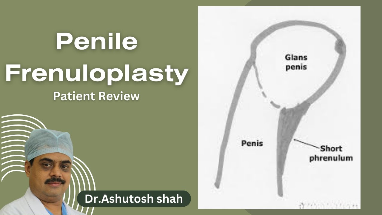 Patient Review On Effective Treatment For Circumcision And ...