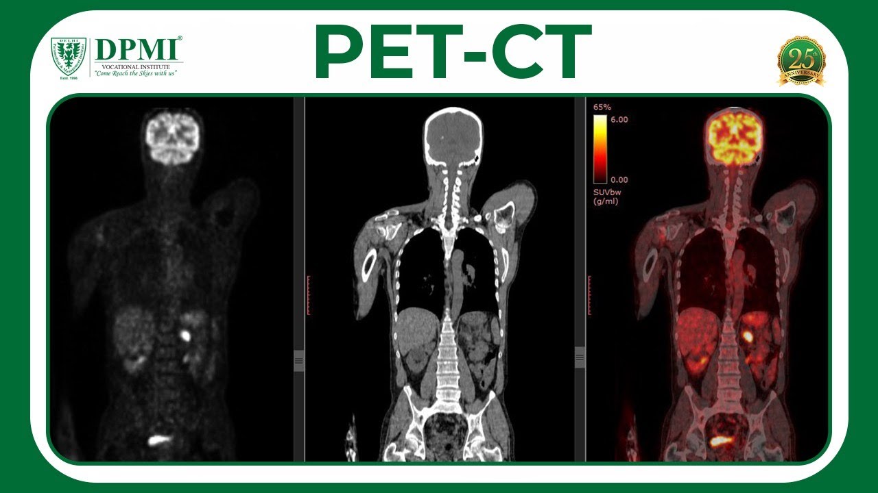 Positron Emission Tomography (PET-CT) Scan: How PET Scans Work? What Is ...