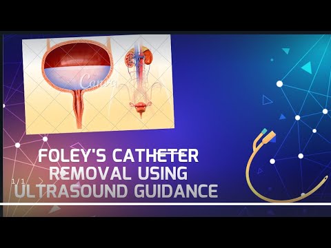 blocked foley's catheter removal using ultrasound - YouTube