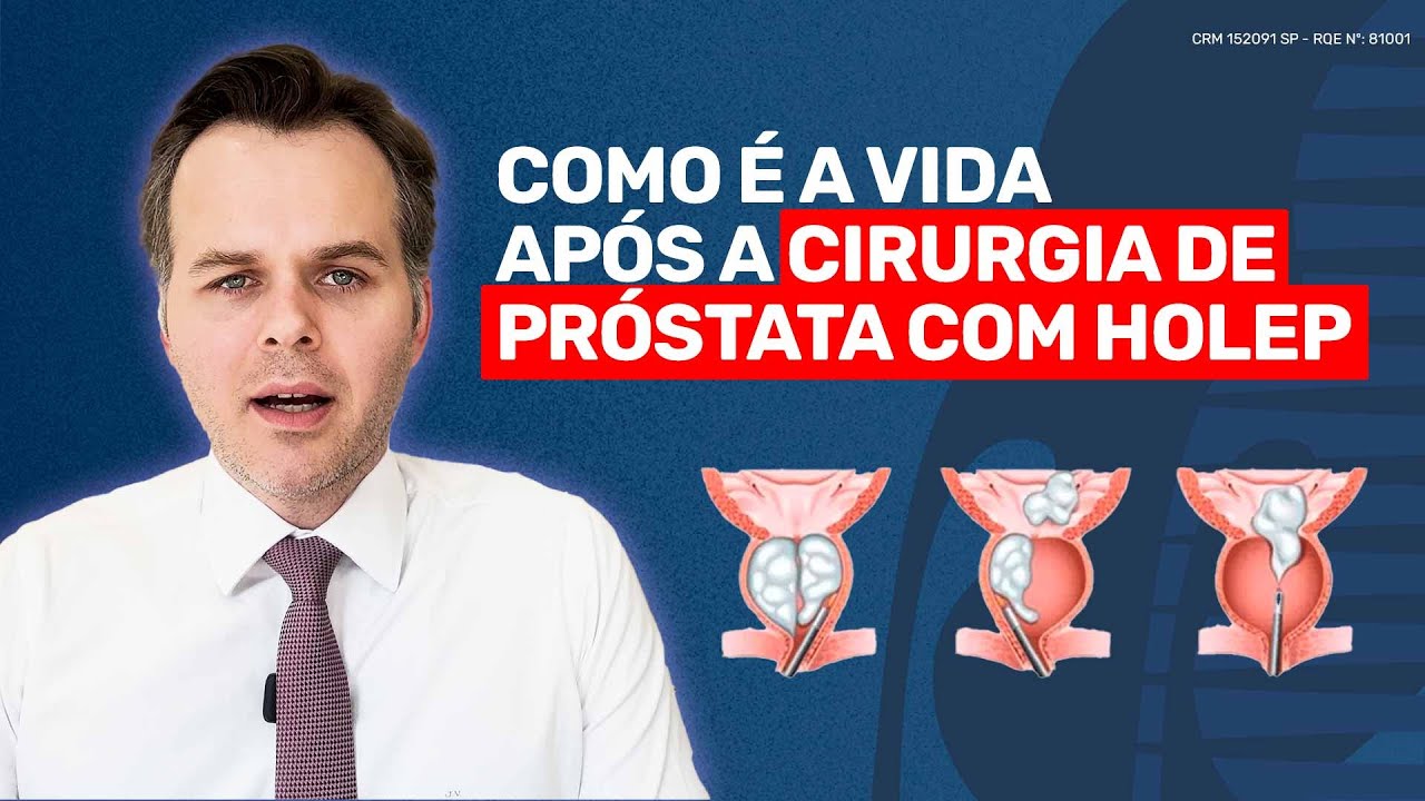RESULTADOS CIRURGIA DE PRÓSTATA HOLEP | O QUE ESPERAR SOBRE RECUPERAÇÃO ...