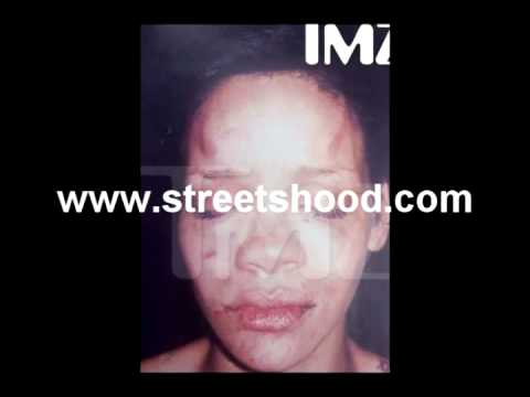 Pictures Of Rihanna after Chris Brown Attack - YouTube