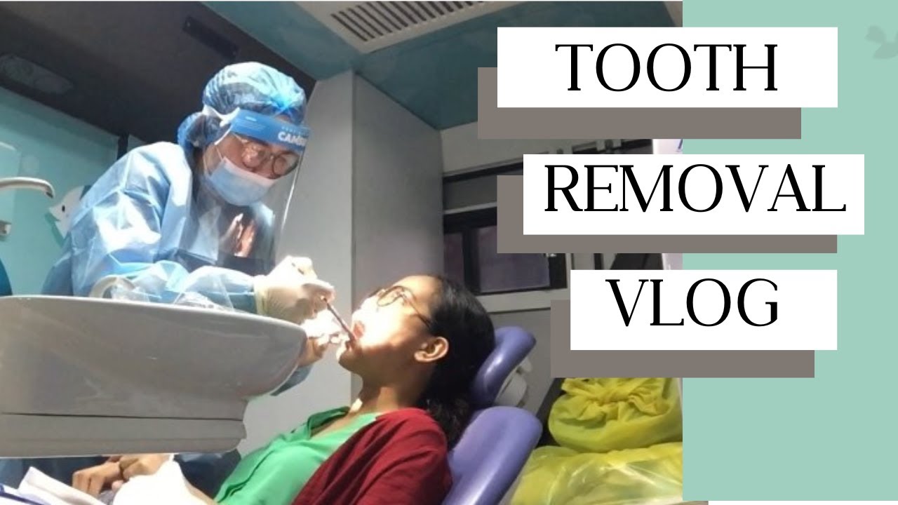 VLOG 025 | TOOTH REMOVAL!!!! - YouTube