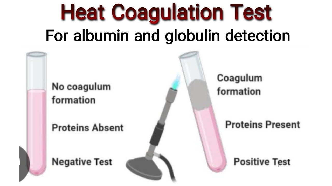 Heat Coagulation Test for identification of Albumin and Globulin ...