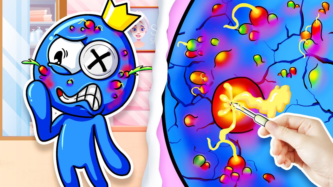 파란색과 분홍색 첫 데이트💘 여드름을 즉시 제거하는 방법? || Kool Stop Motion 한국인 - YouTube