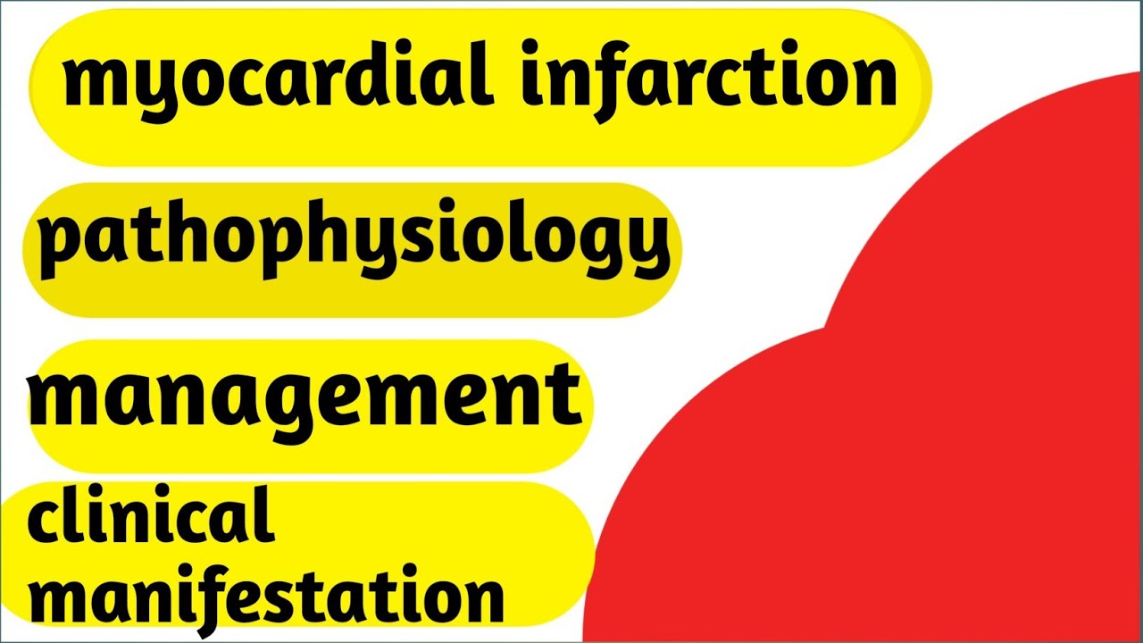 myocardial infarction | definition | causes | clinical manifestation ...