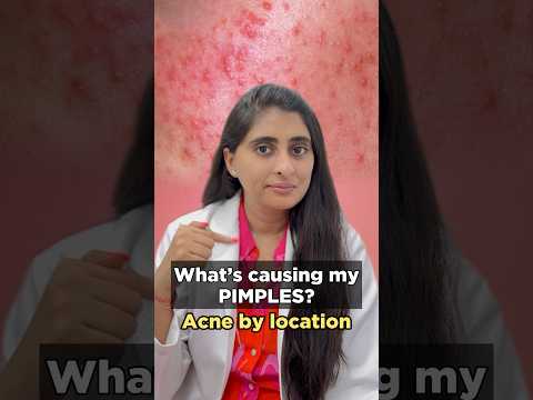 How To Control Heat Pimples On Face