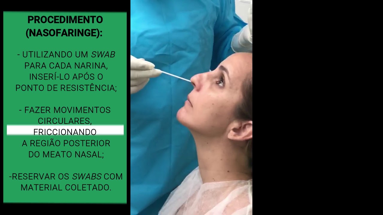Coleta de swab combinado (nasal e orofaringe) - HC/UFPE - YouTube