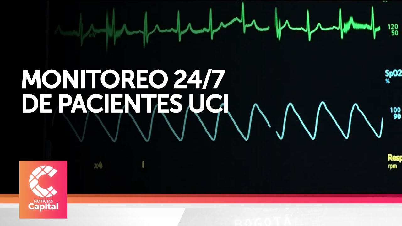 Inauguran central de monitoreo para pacientes de UCi - YouTube