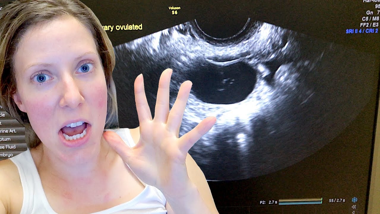 OVULATED!! - YouTube
