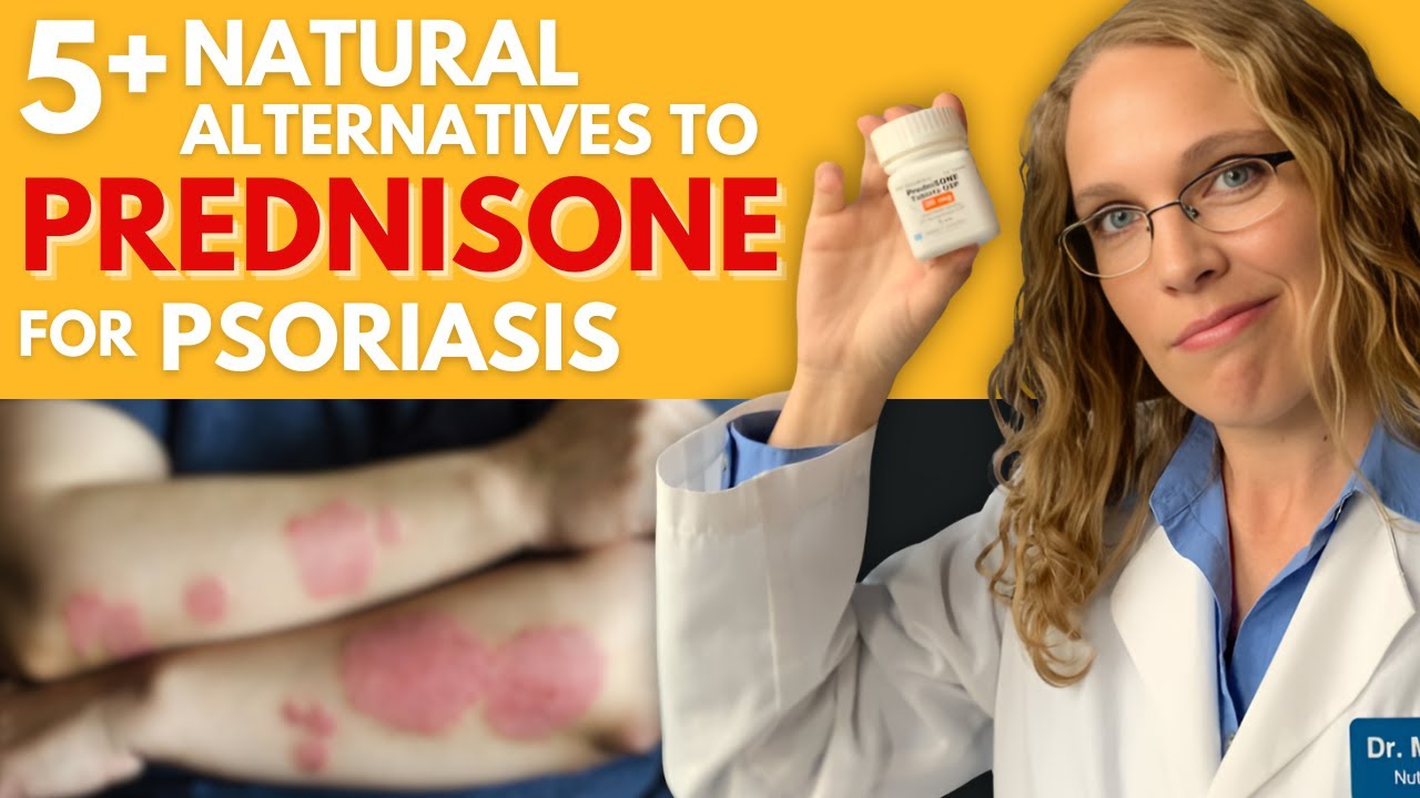 5+ Natural Alternatives to Prednisone for Psoriasis - YouTube