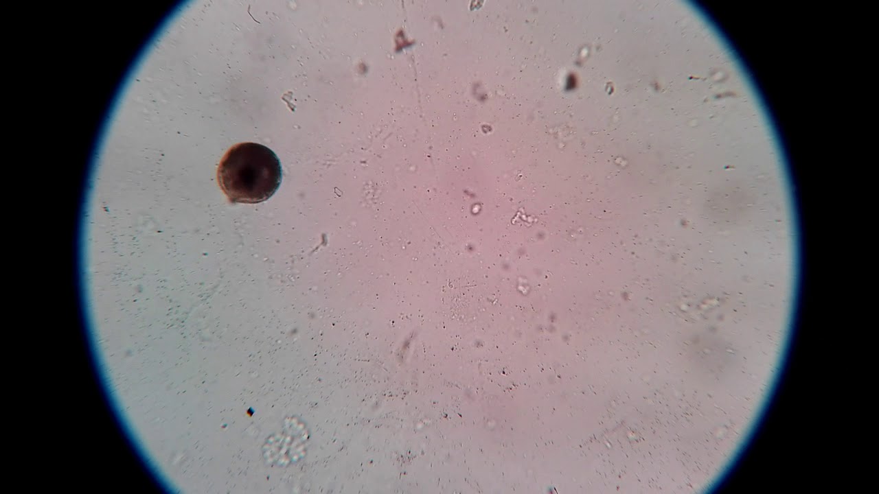 Ichthyophthiriasis fish - YouTube