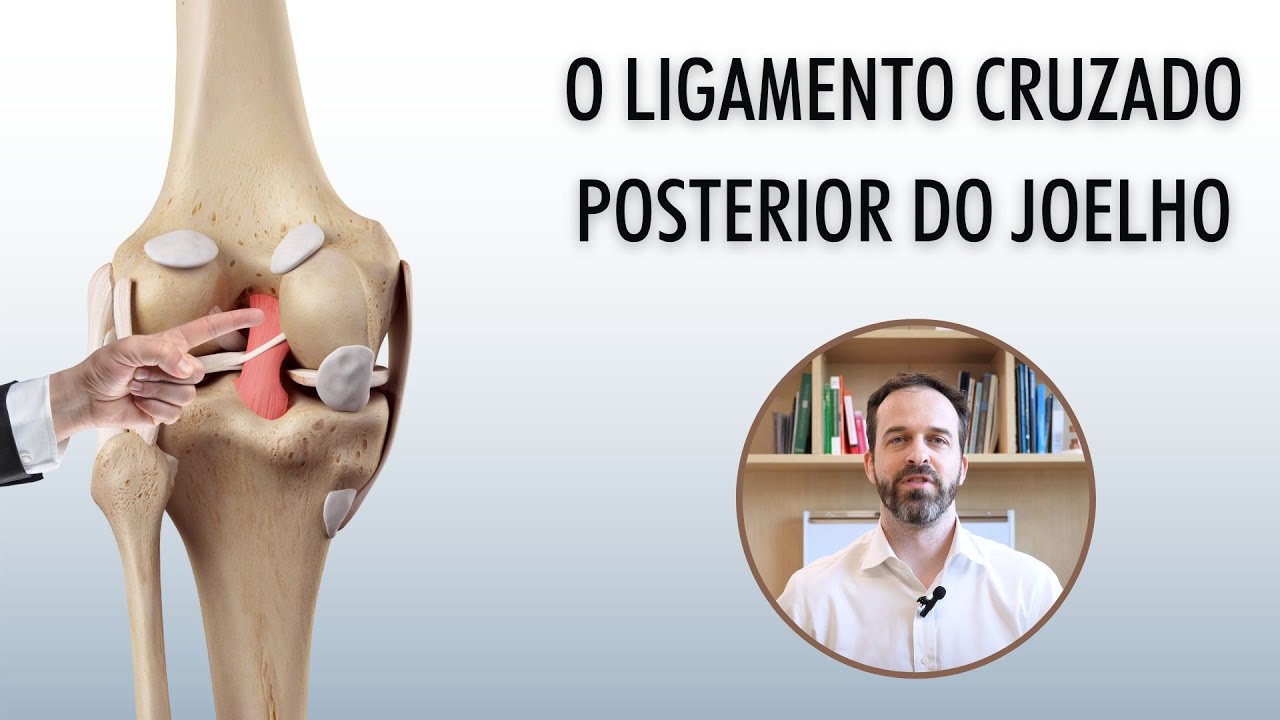 Ligamento Cruzado Posterior - Localização, lesões e tratamentos. - YouTube