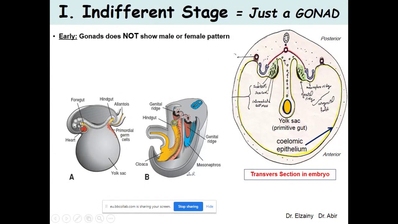 Dr Ahmed Elzainy Development of Genital System Part 1 - YouTube