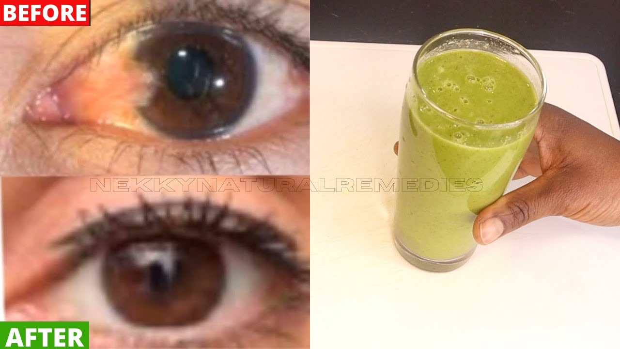 DRINK FOR STRONGER VISION~ The Secret No Doctor Will Ever Tell You ...