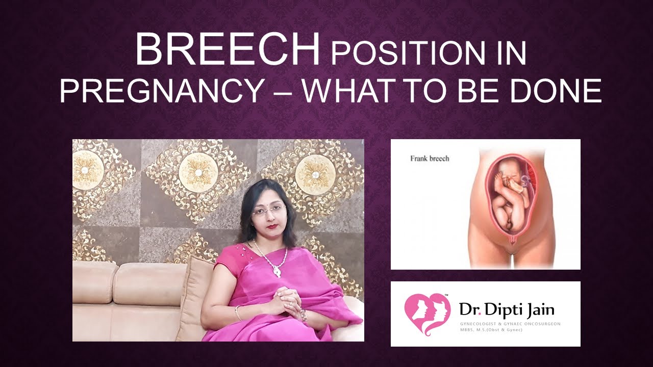 BREECH POSITION IN PREGNANCY - WHAT NEED'S TO BE DONE - YouTube