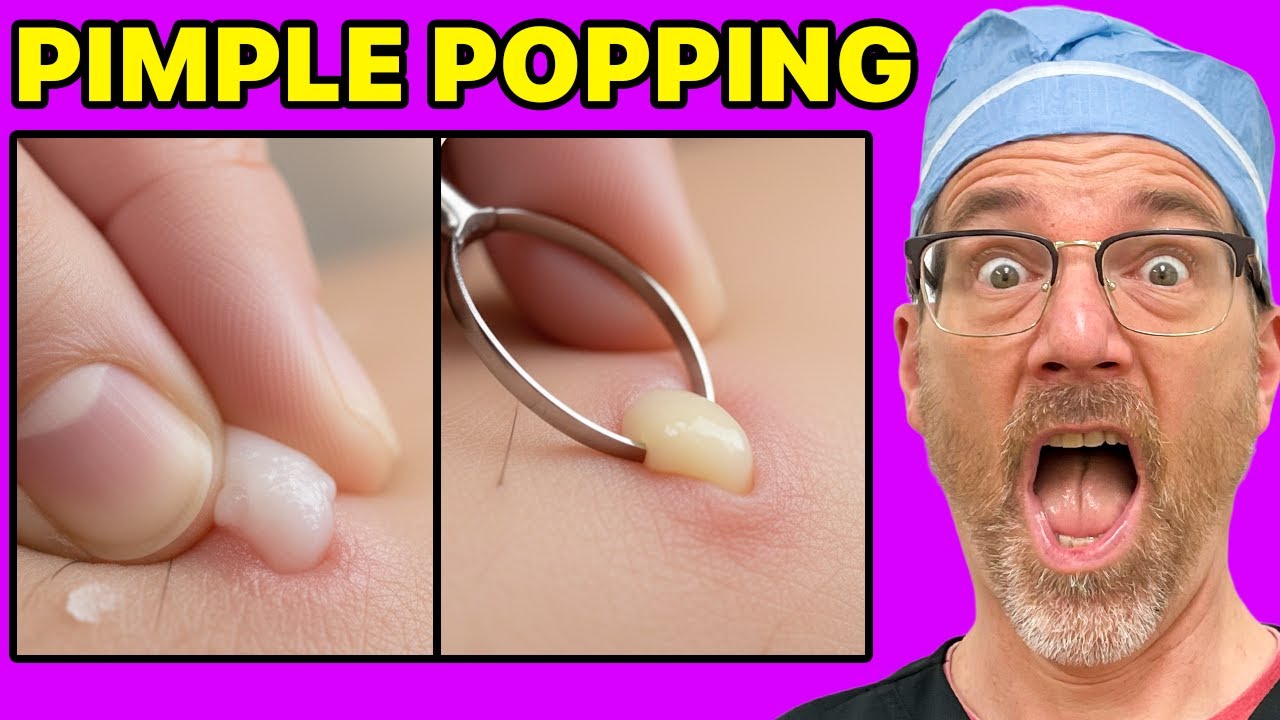 Plastic Surgeon Reacts to EXTREME Pimple Popping - YouTube