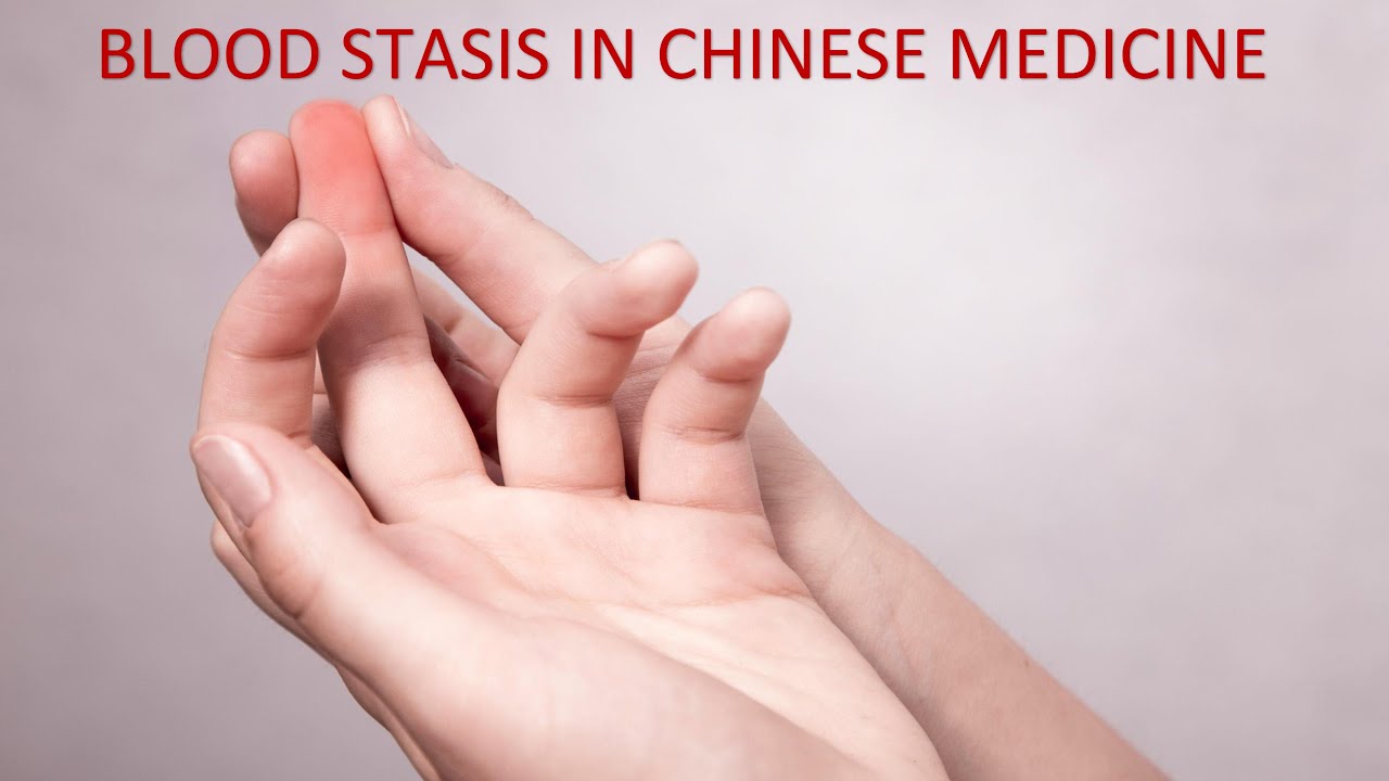 BLOOD STASIS IN CHINESE MEDICINE - YouTube